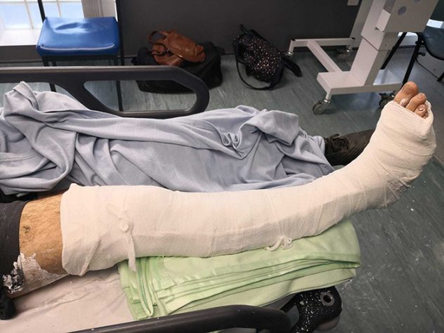 I broke my leg playing football and this is the story of my NHS ...